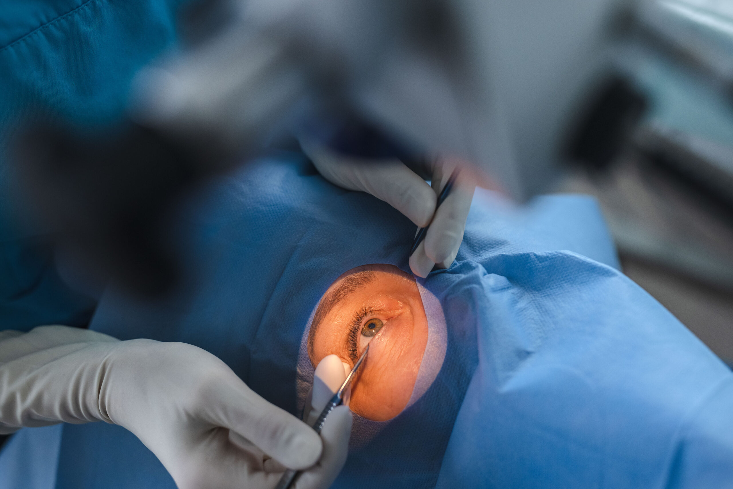 Chalazion or Meibomian Cyst • Turman Eye Clinic