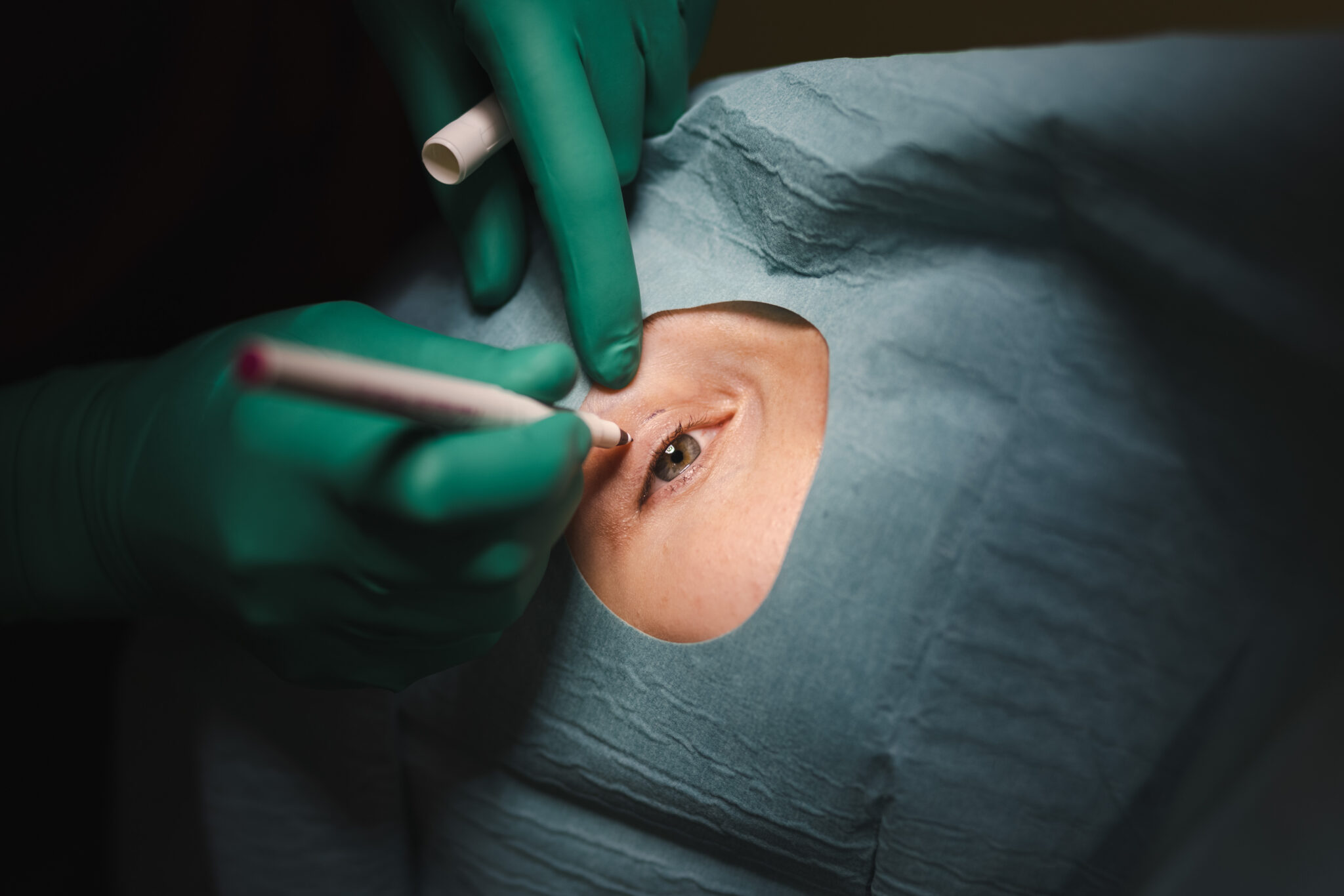 Lauoperatsioon • Turman Silmakliinik